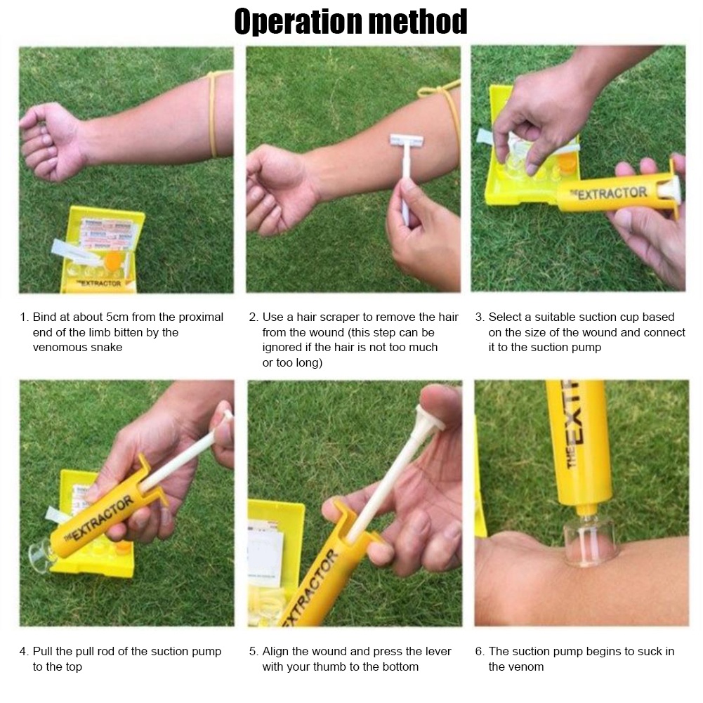 Mosquito Bee Bite Vacuum Suction Pump Wild Venomous Bee Insect Sting ...