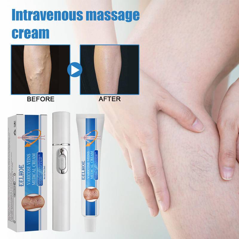 EELHOE Varicose Veins Relief Cream Vasculitis Phlebitis Spider Pain ...