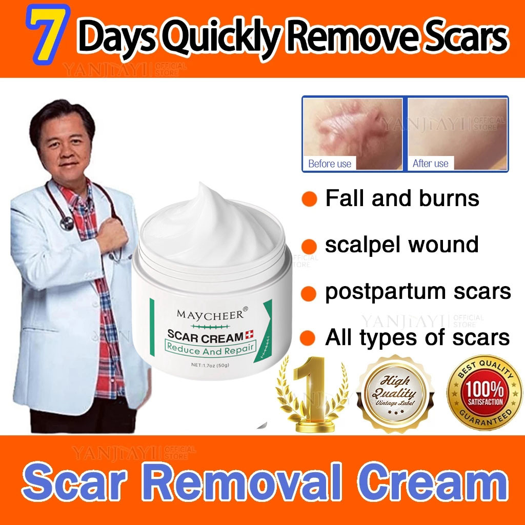 50G Stretch Mark Remover Scar Gel Fix Scar Peklat Remover Cream Scar ...