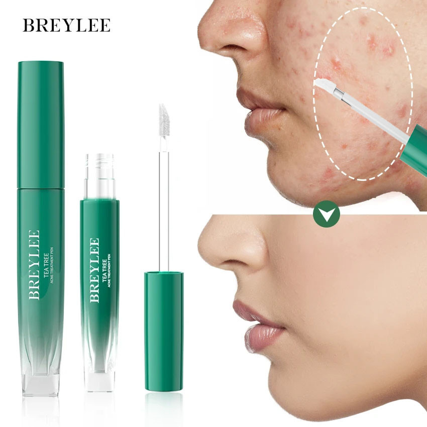 BREYLEE Tea Tree Essence Acne Treatment Pen Repair Acne Remove Acne ... BREYLEE Tea Tree Essence Acne Treatment Pen Repair Acne Remove Acne ...