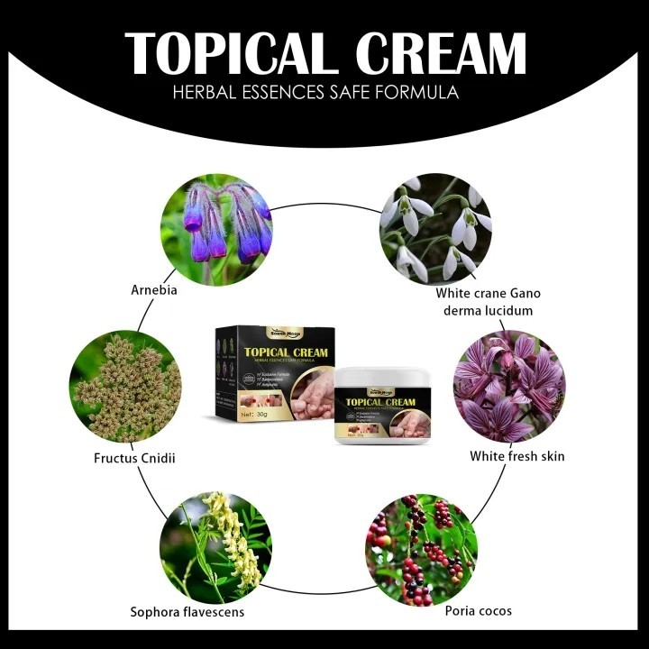 Topical Cream Psoriasis Eczema Cream Anti Itching Dermatitis Treatment ...