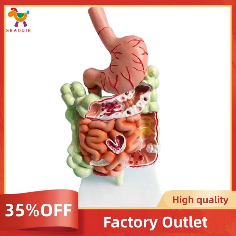 Hot Sale Human Digestive System Model Stomach Anatomy Large Intestine ...