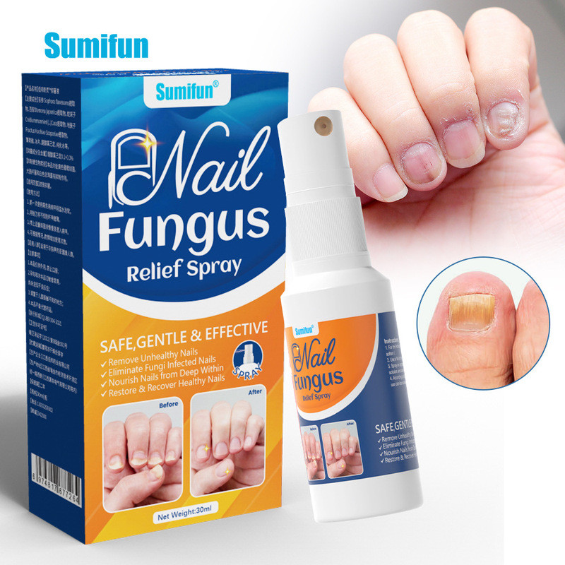 Nail Treatment Essential Anti Fungal Infection Toe Hand Foot Skin Care ...