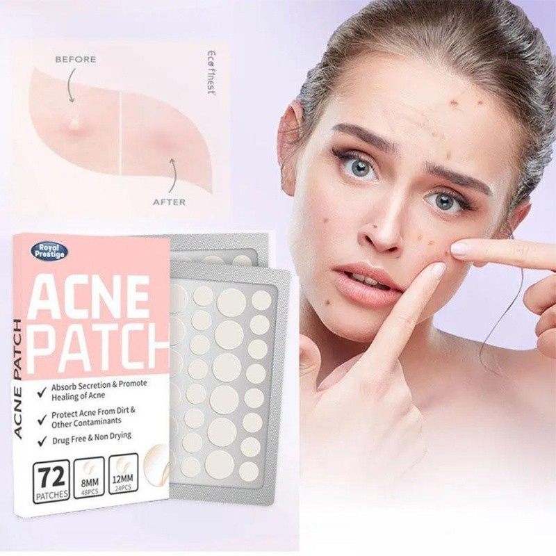 72Pcs Acne Patch Salicylic Acid Pimple Patch Cute Waterproof Invisible ...