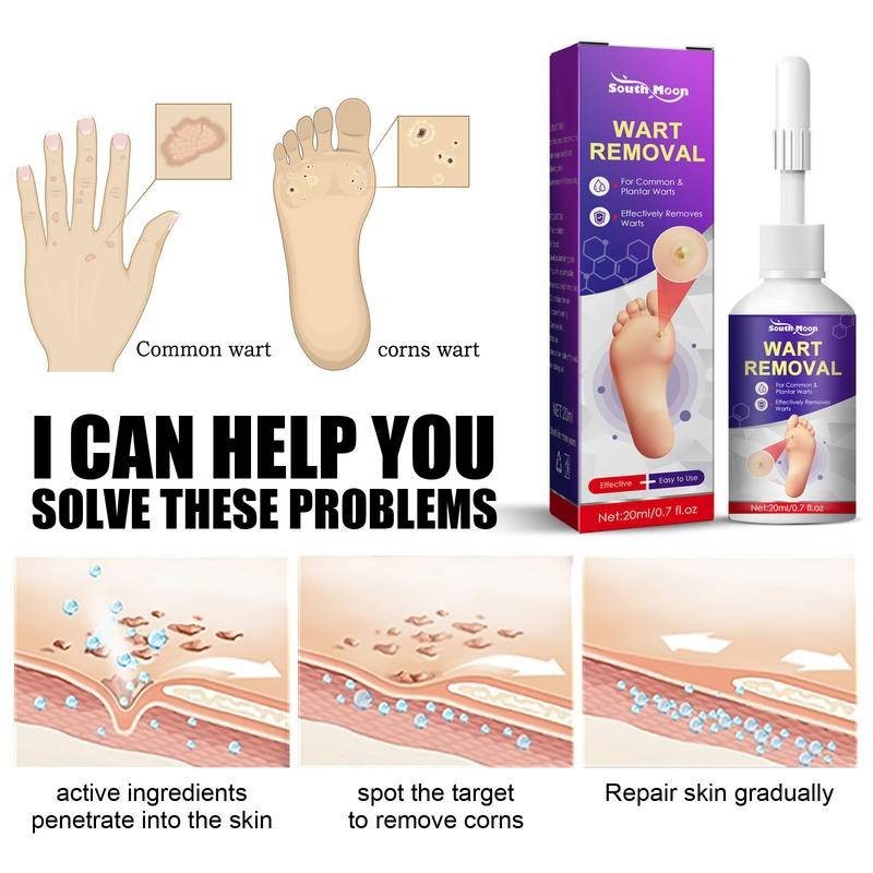 20ML Remover Foot Corn Care Liquid For Eyelet/Warts/Thorn Monkey/Fleshy ...