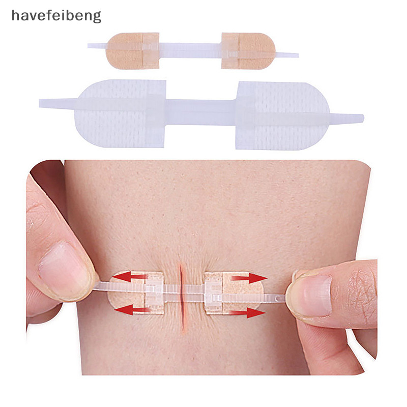 havefeibeng Zipper Tie Wound Closure Patch Hemostatic Patch Wound Fast ...