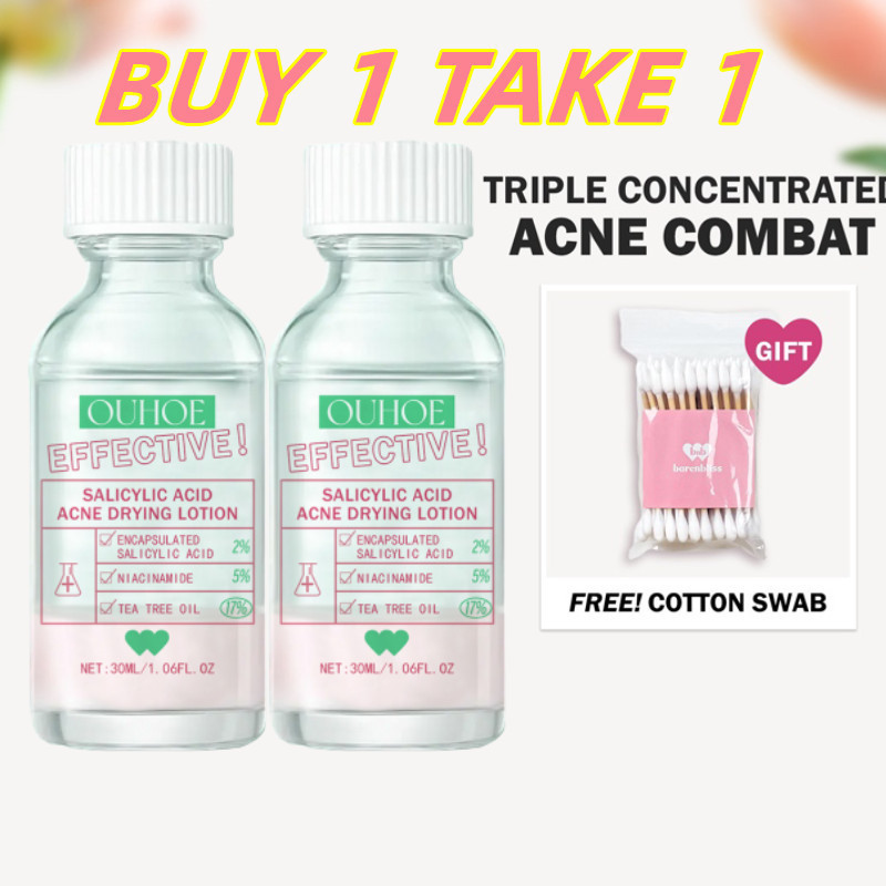 【BUY 1 TAKE 1】Pimple Warrior Salicylic Acid Acne Drying Lotion - Acne ...