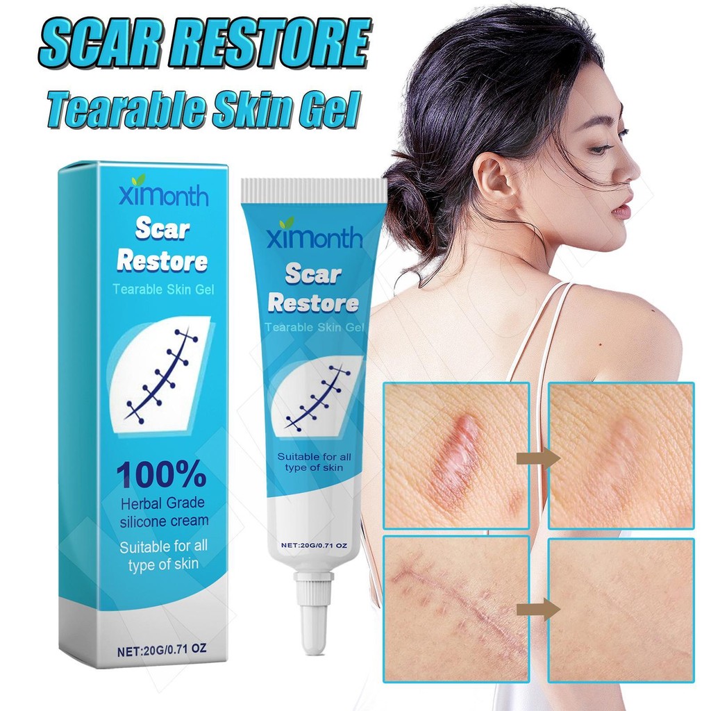 Silicone Scar Gel Natural Burn Scar Cream Skin Softening for Smoothing ...