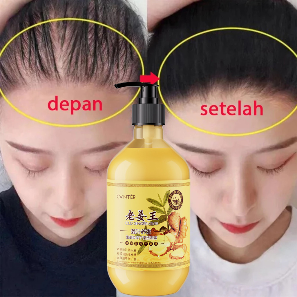 Ginger anti hair loss shampoo Natural Hair Growth Strengthens Roots ...