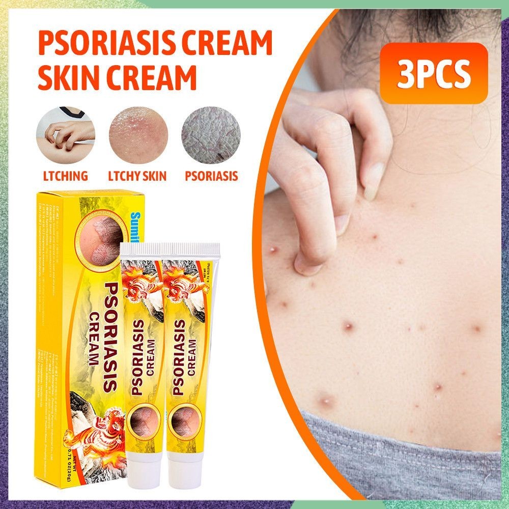 Sumifun 3pcs Psoriasis Ointment Skin Cream Dermatitis Eczema Tinea