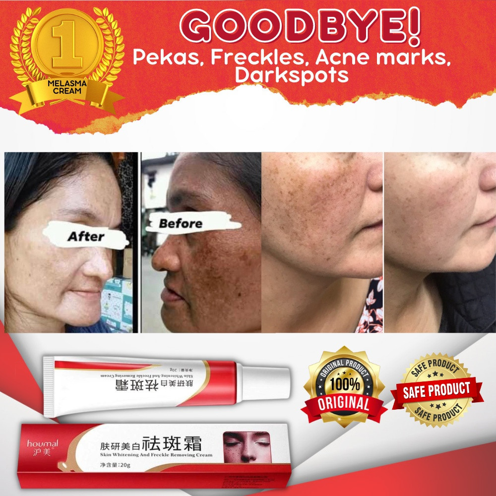 Pekas Remover Effective Melasma Cream Anti Freckle Collagen Original ...