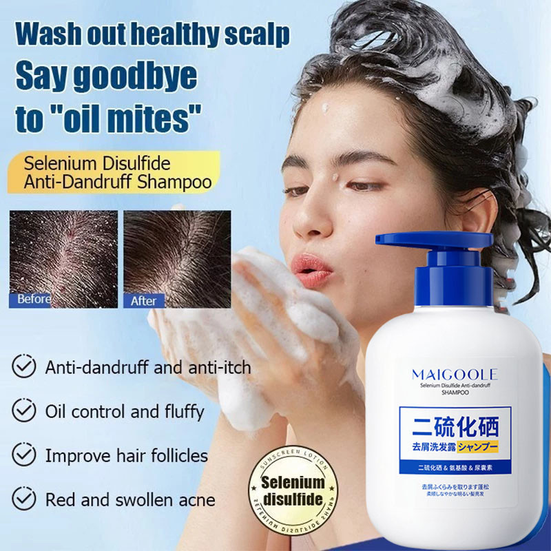 Psoriasis Shampoo Hair Care Smooth Scalp Treatment Dandruff Shampoo ...