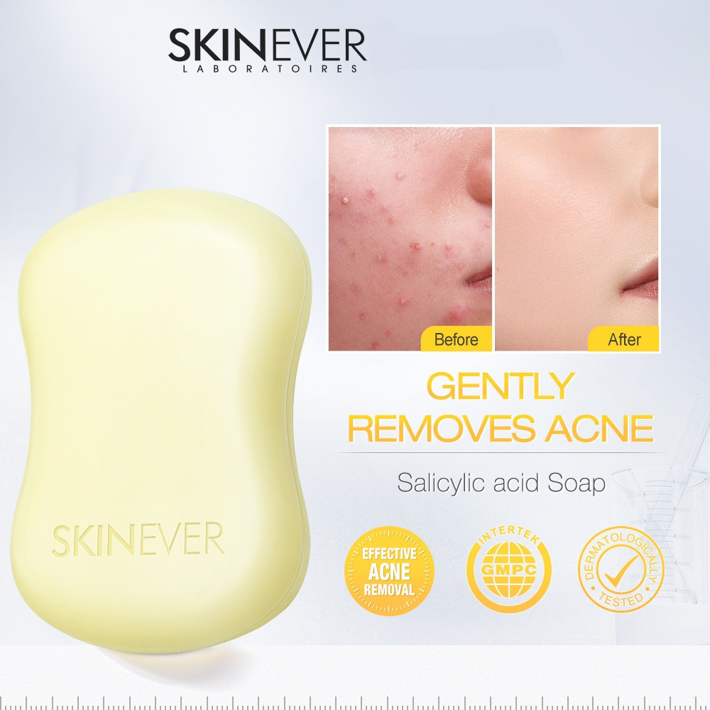 SKINEVER SALICYLIC ACID Refreshing Acne Soap Niacinamide Centella ...