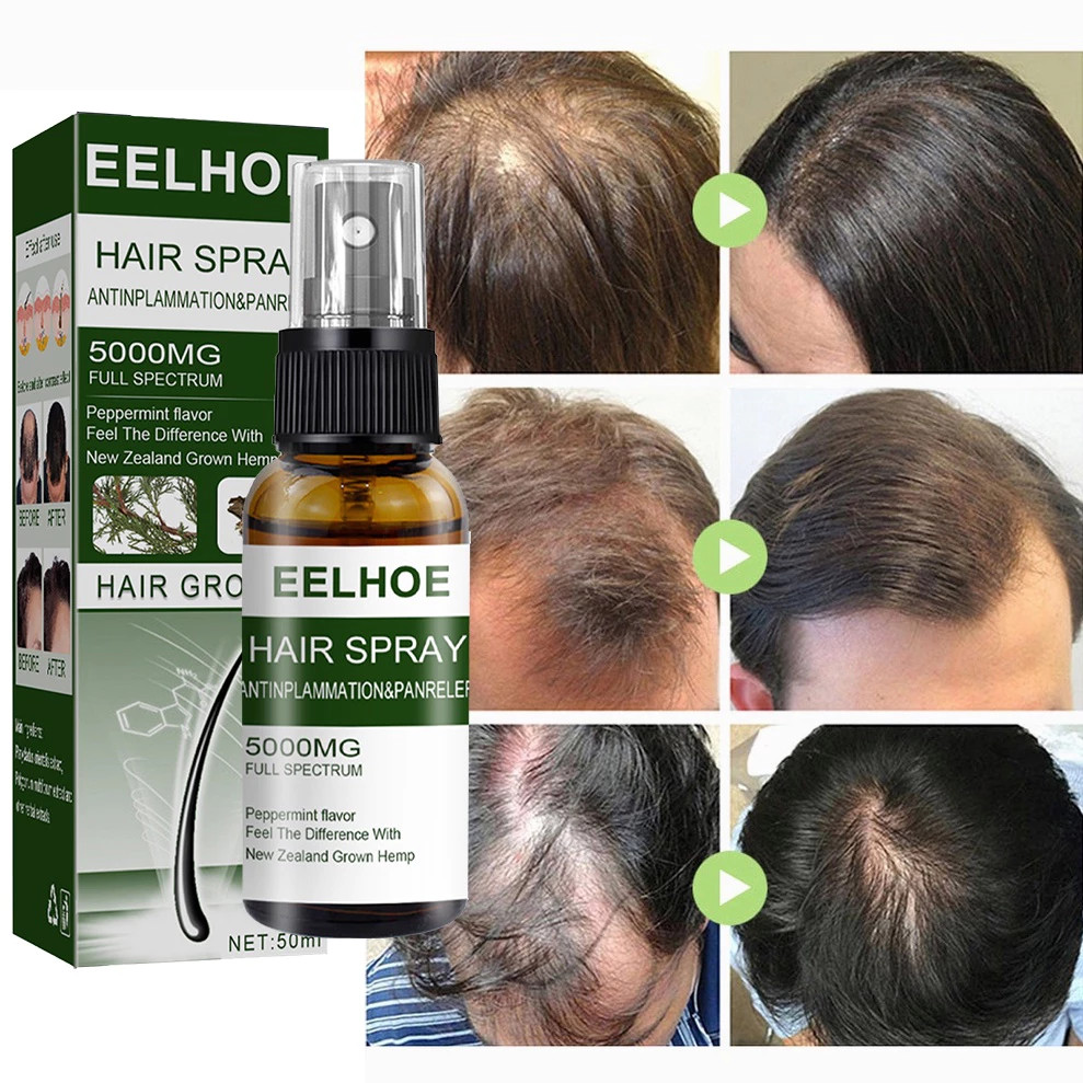 Hair Growth Spray Fast Hair Growth Liquid Treatment Scalp Hair Follicle ...