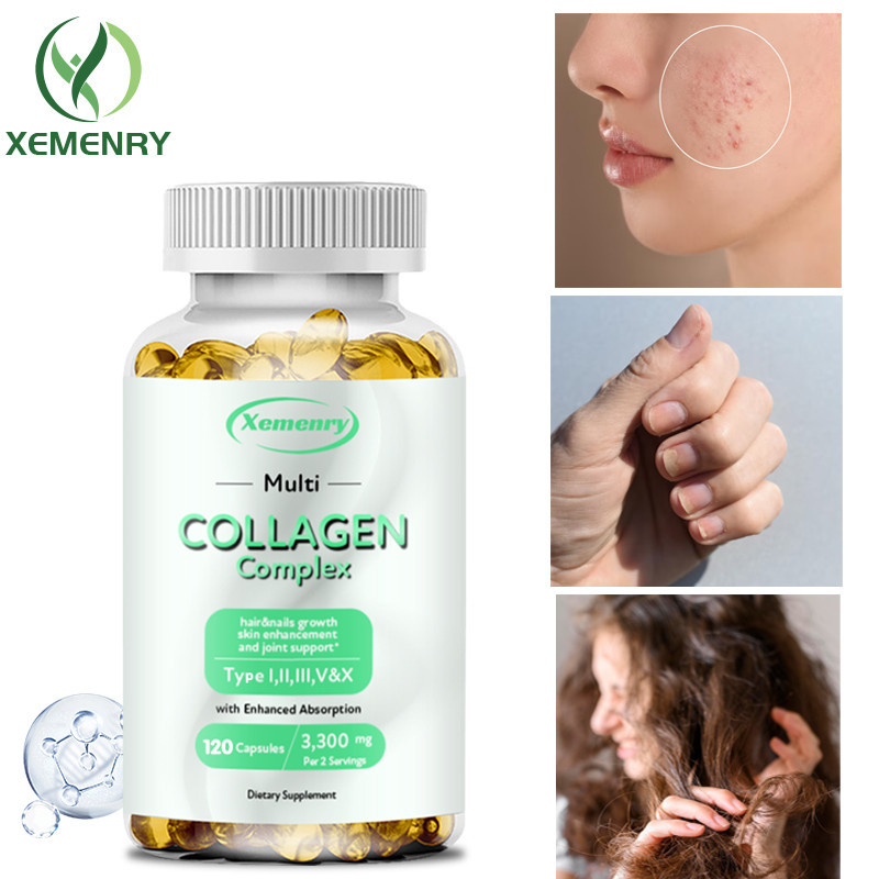 Multi-collagen complex - improves skin, hair and nail health 30/60/120 ...