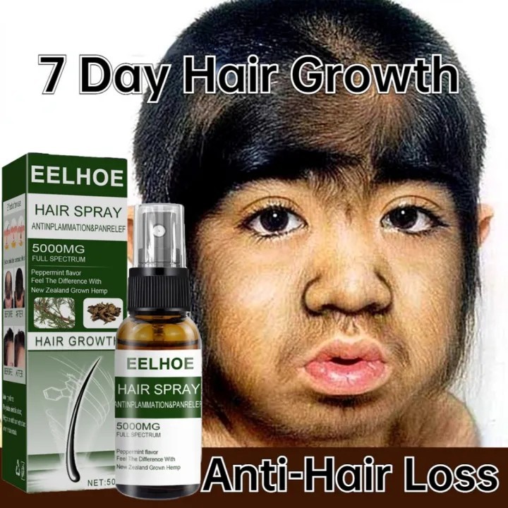 Anti Hair Loss Hair Grower Spray Ginger Novo Hair Growth Treatment ...