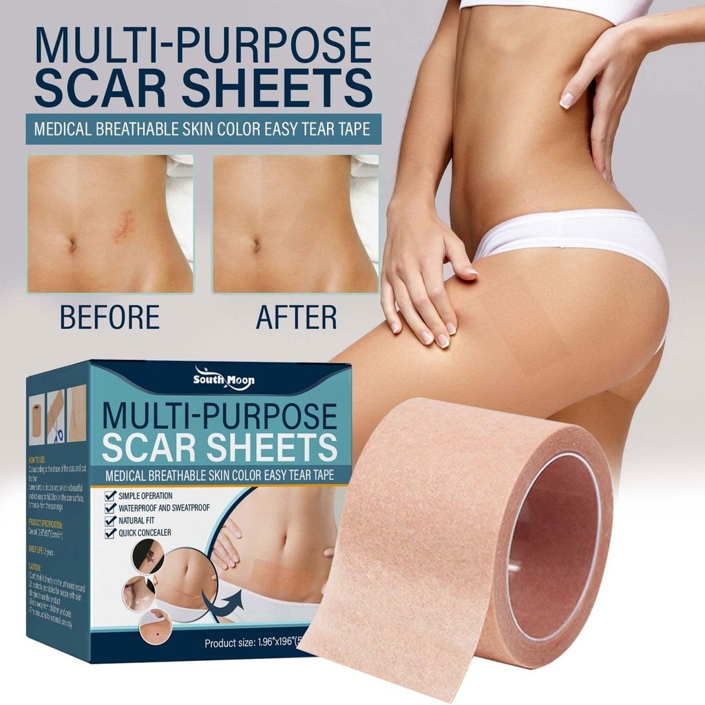 Silicone Scar Sheets Skin Repair Patch Removal Self-adhesive Stretch Tape Scar Mark | Shopee ...