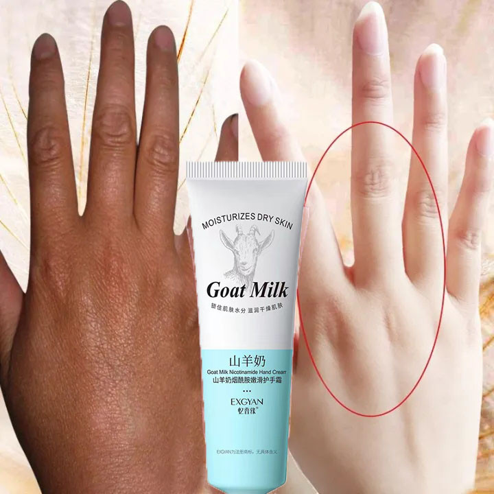 Moisturizing Anti Cracking Goat Hand Cream | Shopee Philippines