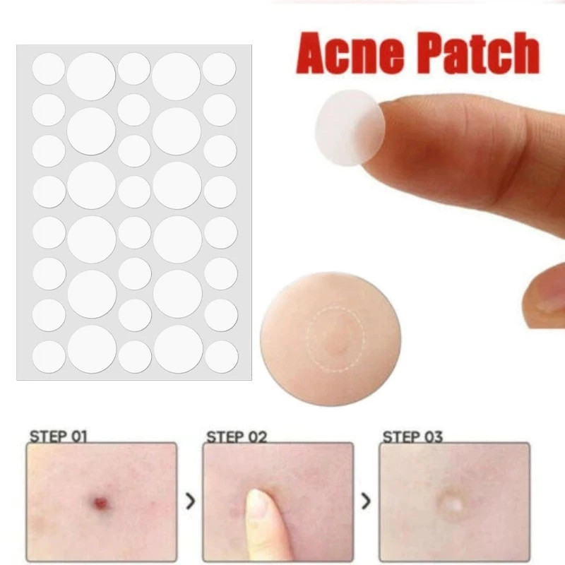 Acne Pimple Patch Lnvisible Acne Pimple Removal Patch Acne Hydrocolloid ...