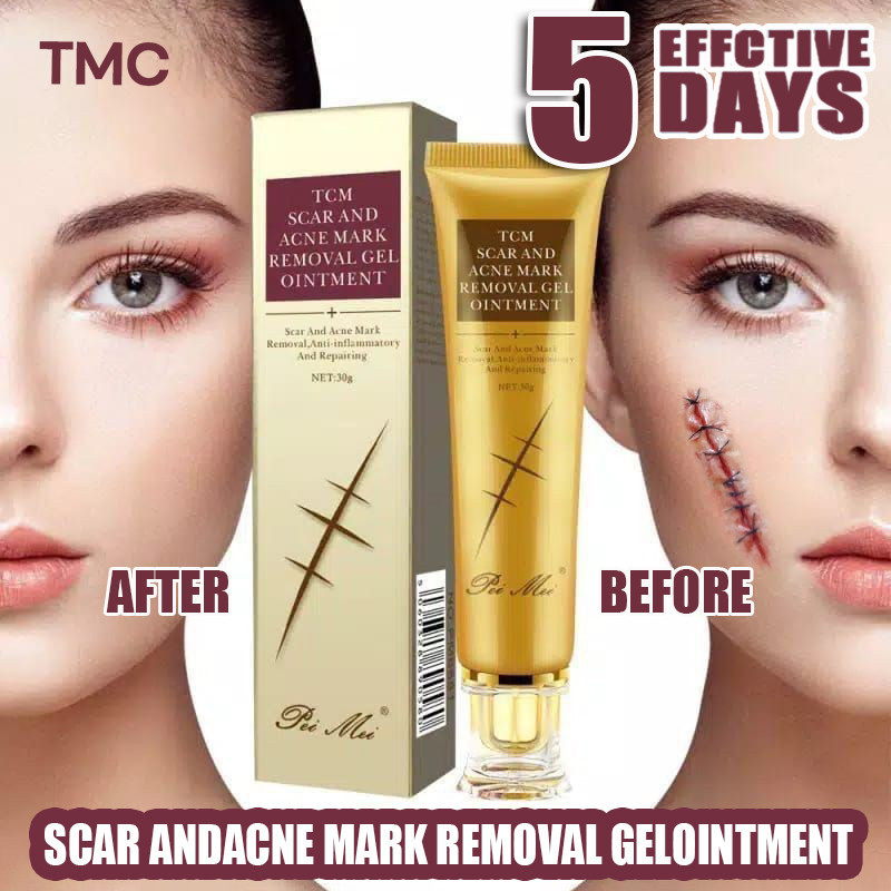 Tcm Scar Andacne Mark Removal Gelointment 30g Acne Scar Removal Gel, Keloid, Burn Scars, Iris ...