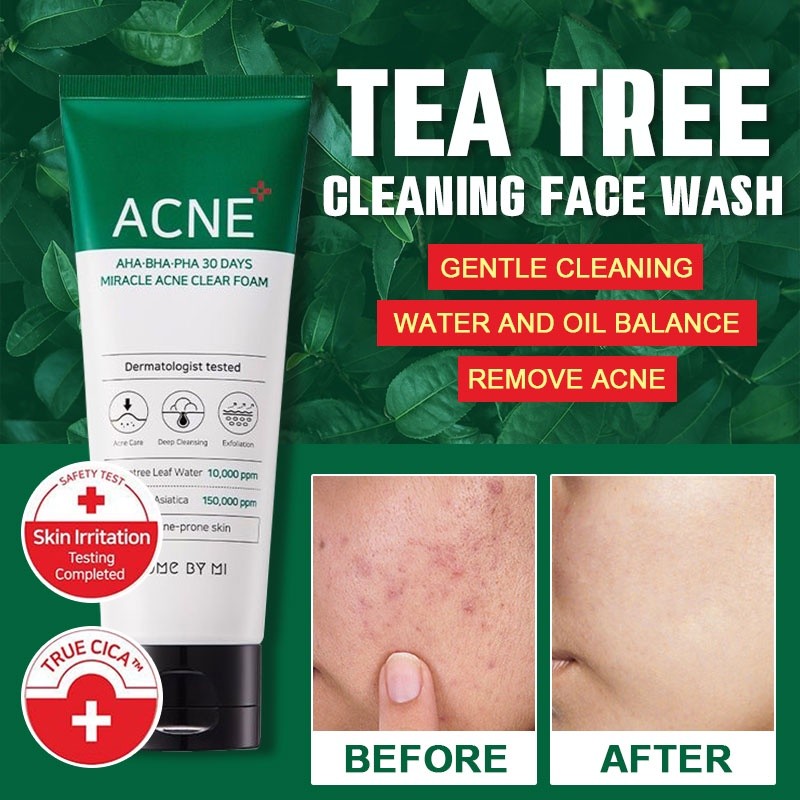 [SOME BY MI] AHA BHA PHA 30 Days Miracle Acne Clear Foam Authentic ...