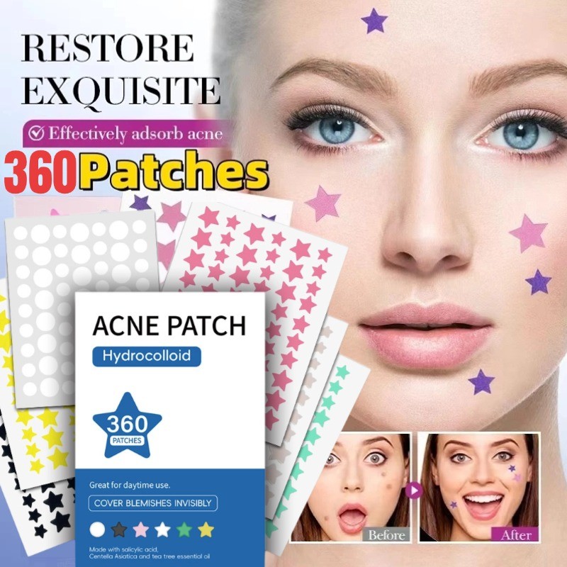 360Pcs Star Pimple Patch Acne Colorful Invisible Removal Skin Care ...