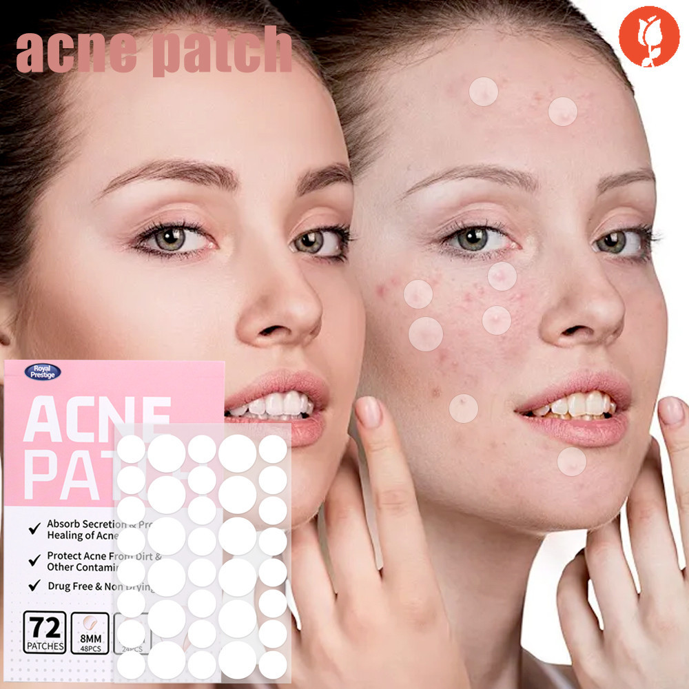 Facial Care Acne Removal Treatment Stickers/ Waterproof Self-adhesive ...