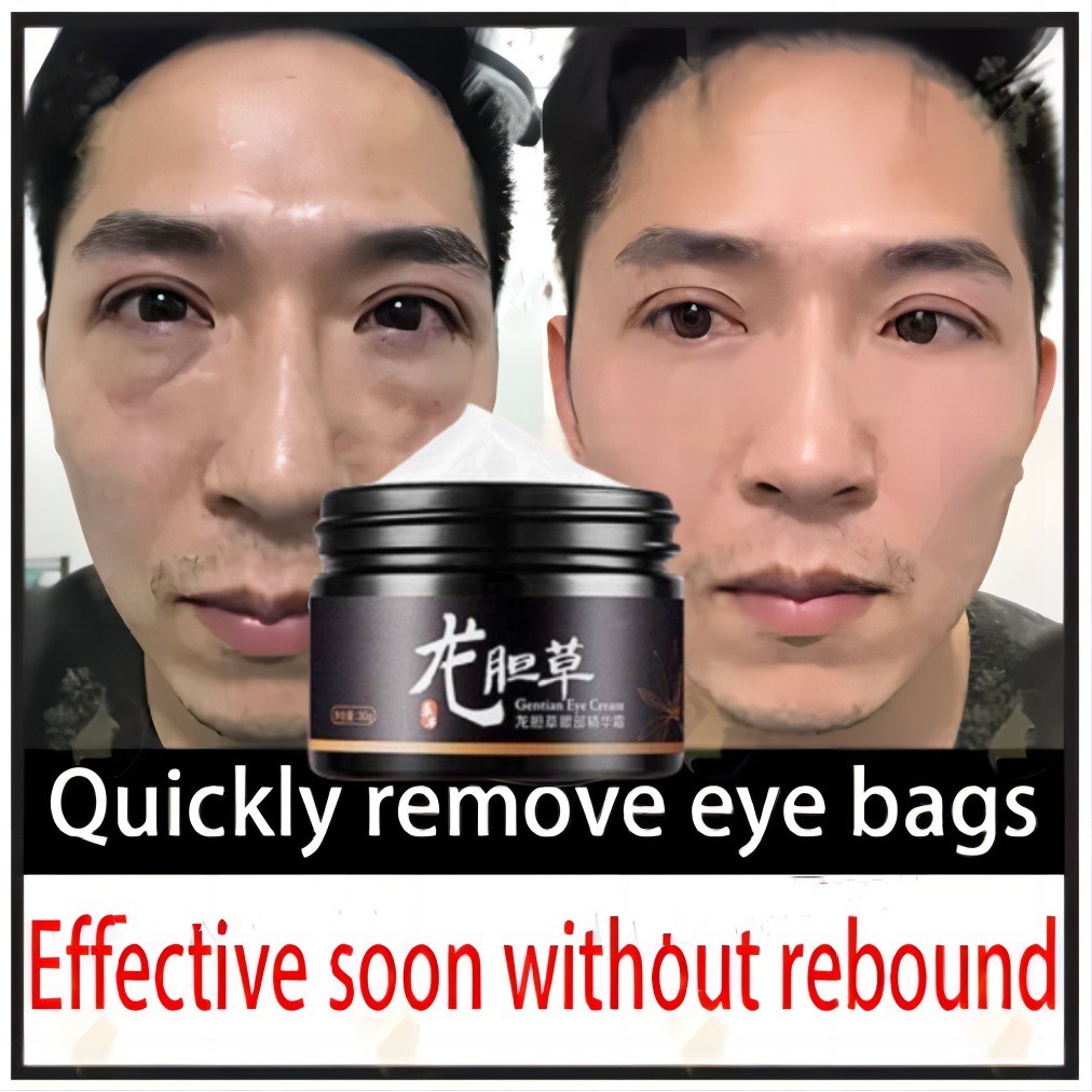 100 % effective Japanese eye cream Remover Wrinkle Eye Bag Dark Circle ...
