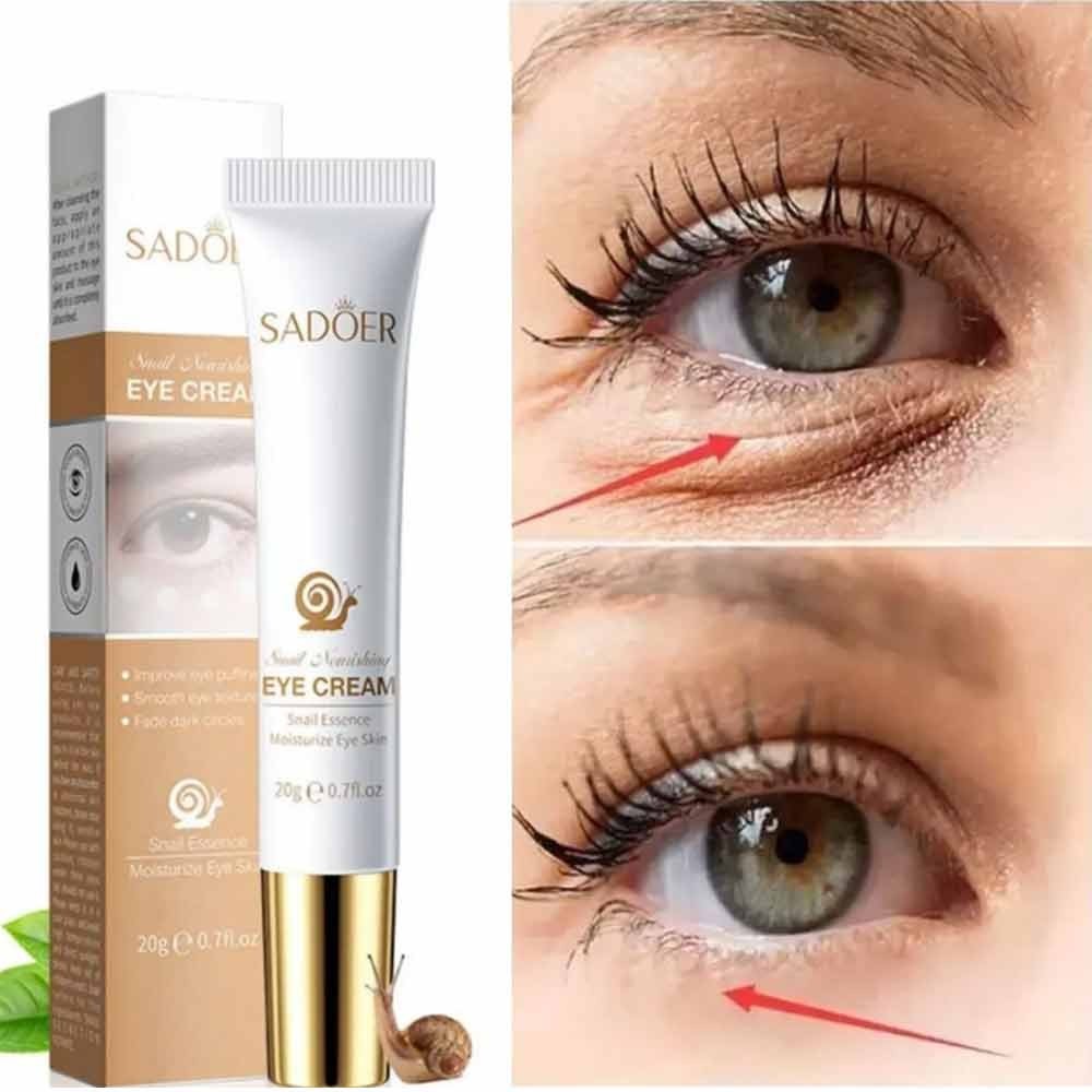 SADOER Snail Eye Cream 20g | Shopee Philippines