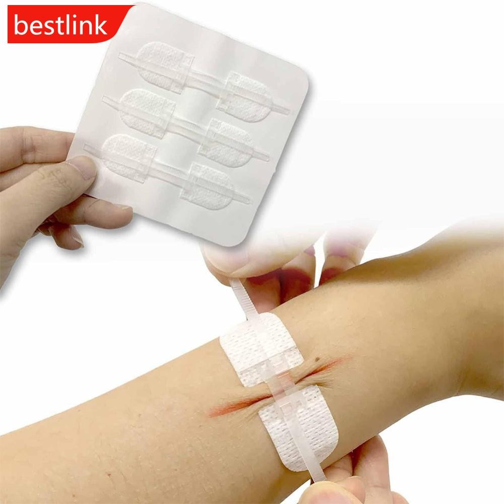 BESTLINK 3Pcs/set Band-Aid Zipper Tie Wound Closure Patch Hemostatic ...