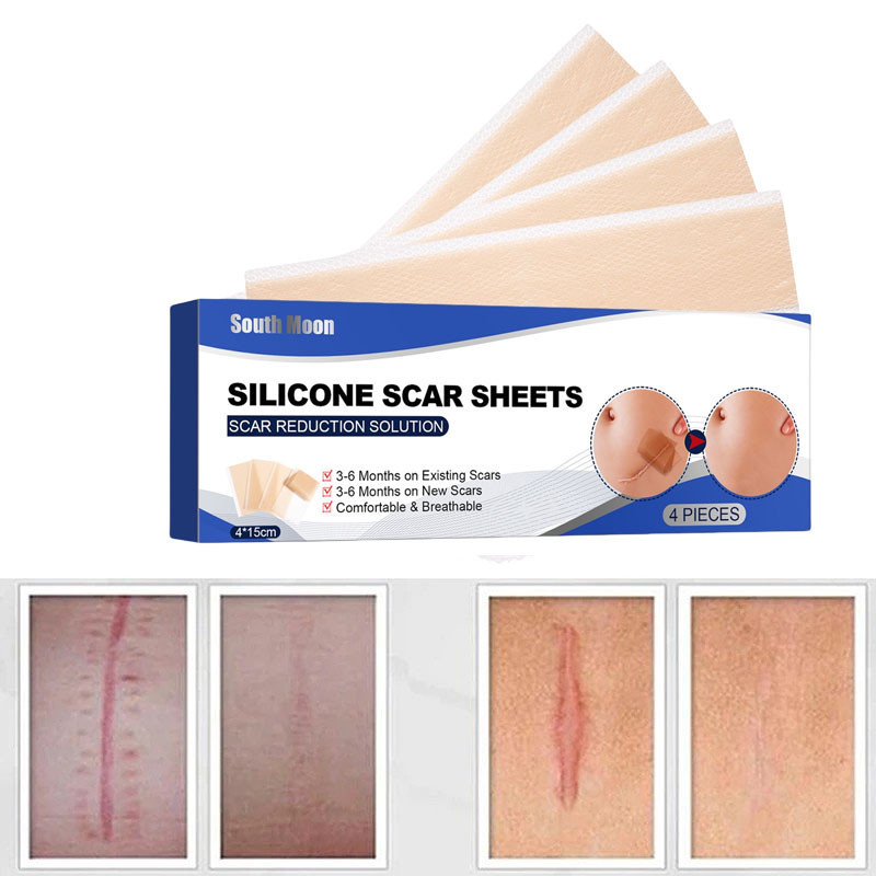 Beauty Silicone Scar Removal Silicone Gel Self-Adhesive Tape Patch for ...