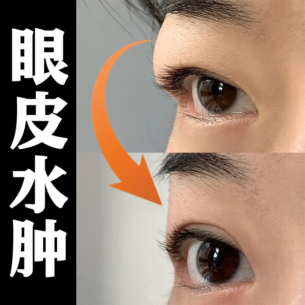 现货 Wake up swollen eye bubble eyes to edema eyelid swelling eyes stay ...