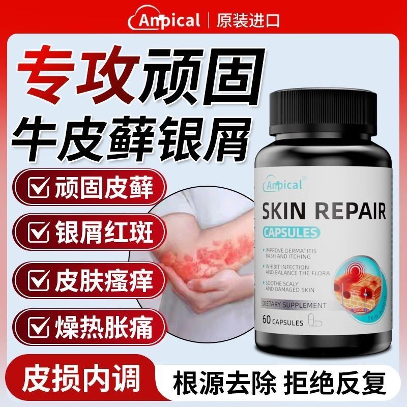 Imported Cowhide Silver Chips Disease Dedicated Non-Ointment Treatment ...