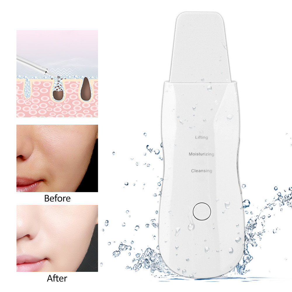 Ultrasonic Skin Scrubber Deep Face Cleaning Machine Peeling Shovel ...