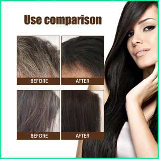 30ml Anti-grey Hair Essence To Restore Gray Hair Natural Hair Color ...
