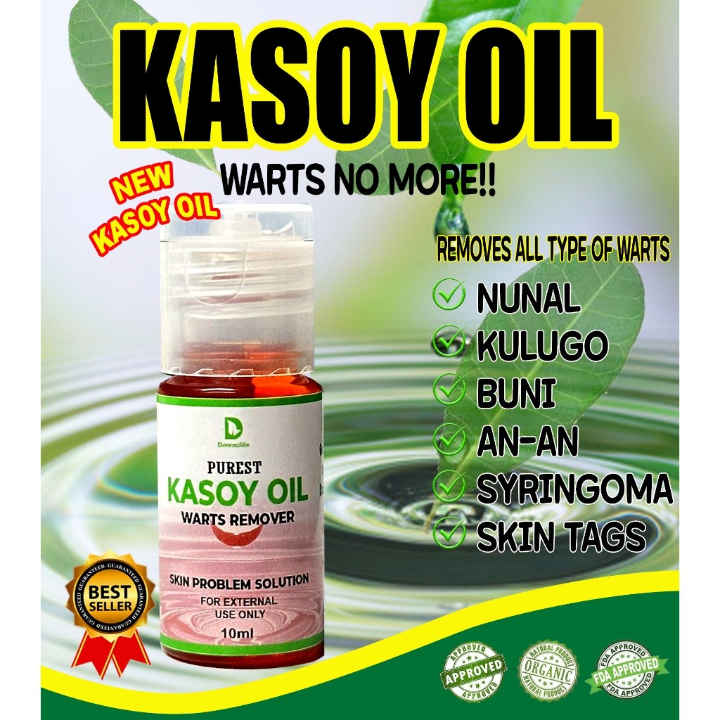 KASOY OIL ORIGINAL KULUGO SYRINGOMA SKIN TAGS WARTS GENITAL WARTS ...