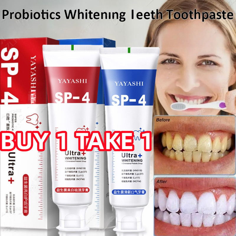 【BUY 1 TAKE 1】Probiotic Toothpaste SP-4 Whiten Tooth Decay Repair Paste ...