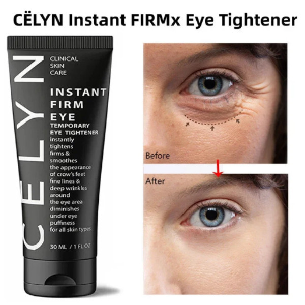 CELYN 30ml Instant Firm Eye Cream Reduce Fine Lines and Dark Circles ...