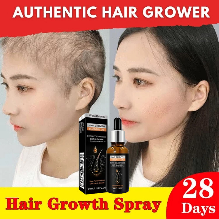 Hair growth serum Fast hair grower for man and woman Scalp Hair fall ...
