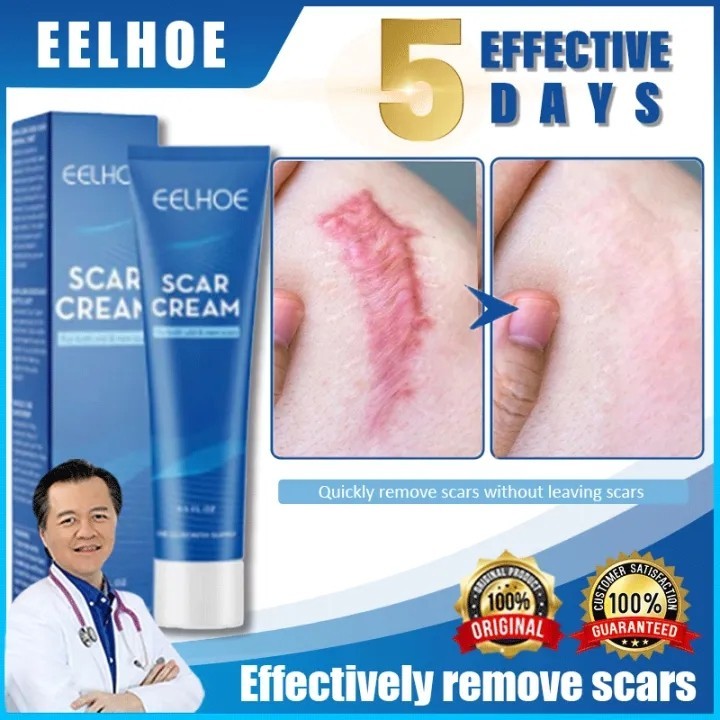 Scar Removal Cream Peklat Remover Acne Treatment Scar remover cream ...