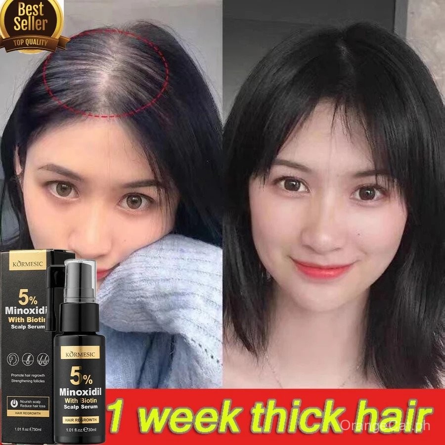 5% Minoxidil Hair Grower Serum with Biotin Regrowth Anti-Dandruff Anti ...
