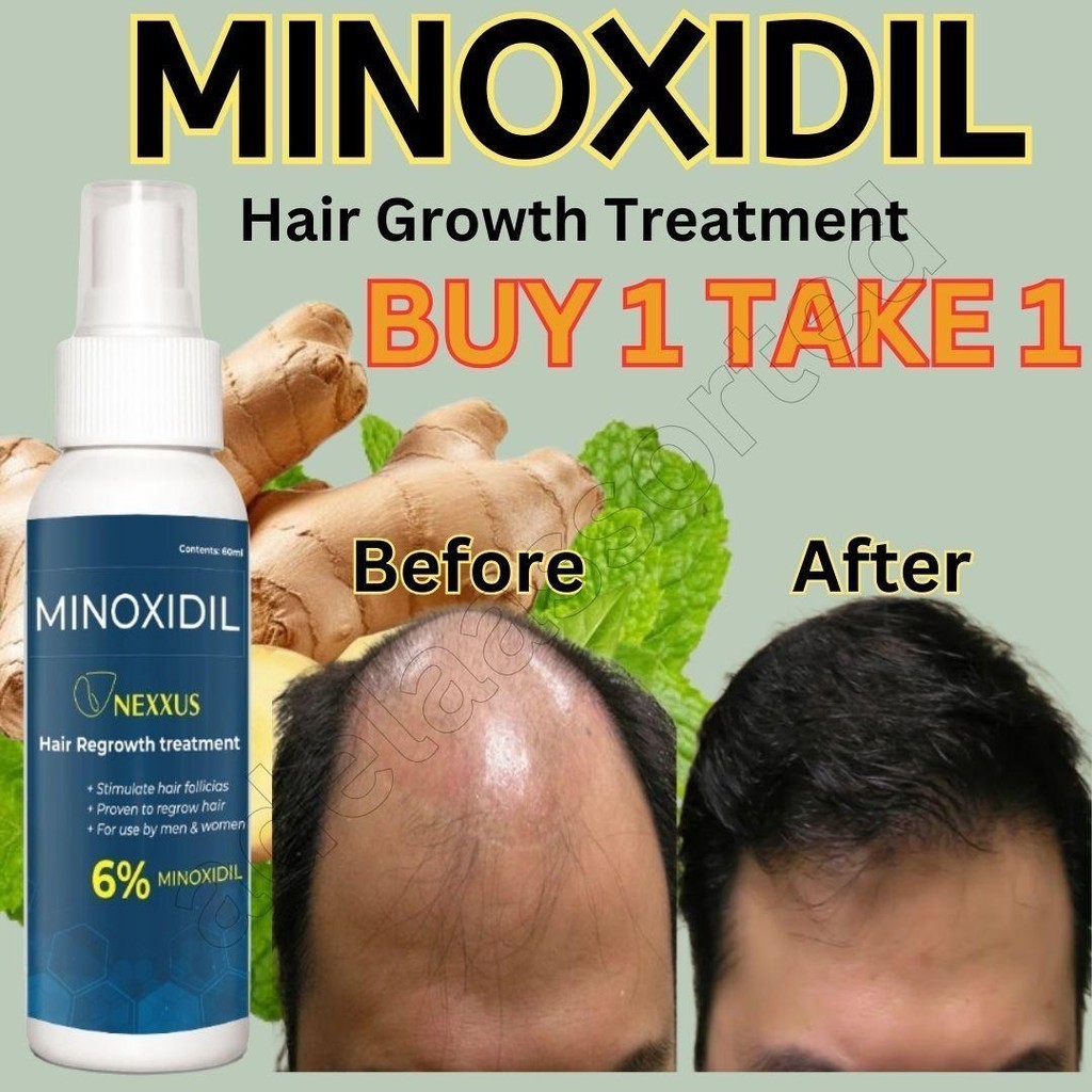 STSF B1t1 Minoxidil 6% 60ml Hair Men and Women Natural Grower Beard ...