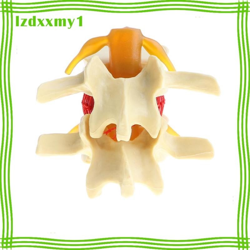 [ Magnify 2 Times Human Spine Vertebrae Degenerative Disc Skeleton ...