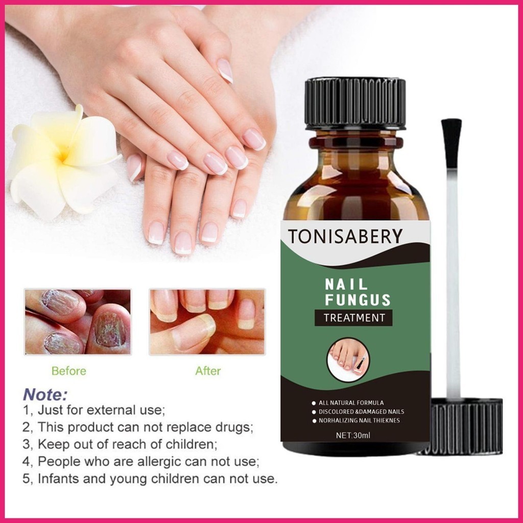Nail Repair Liquid Effective Repairing Liquid 30ml Repair Solution ...