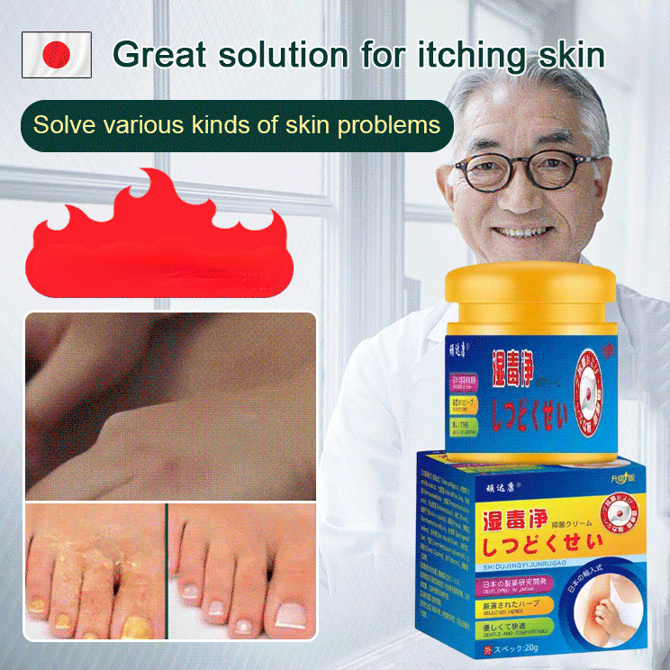 Psoriasis nemesis net cream | Shopee Philippines