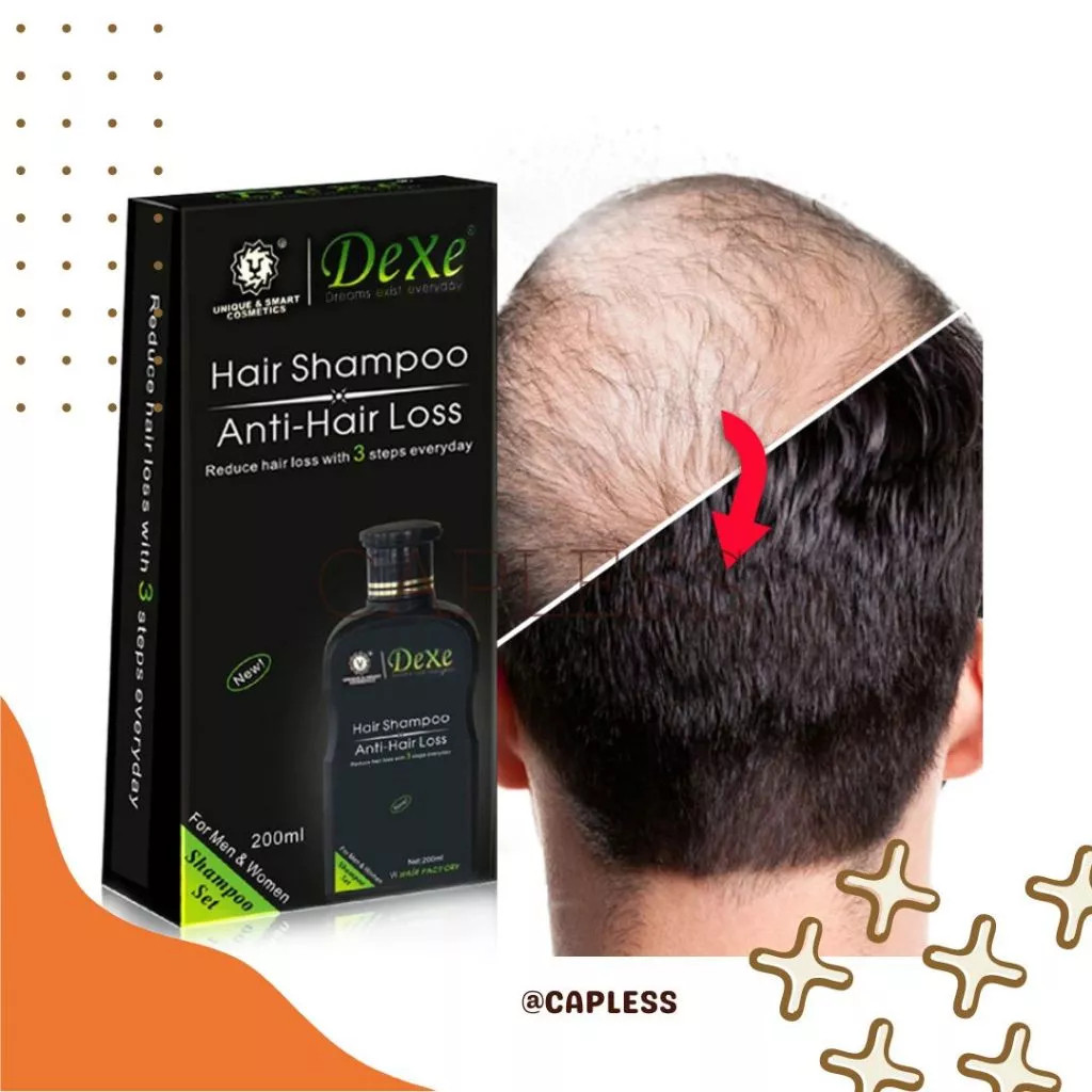 Hair Grower 200ML Anti-Hair Loss Shampoo DEXE Organic Anti Loss Hair ...