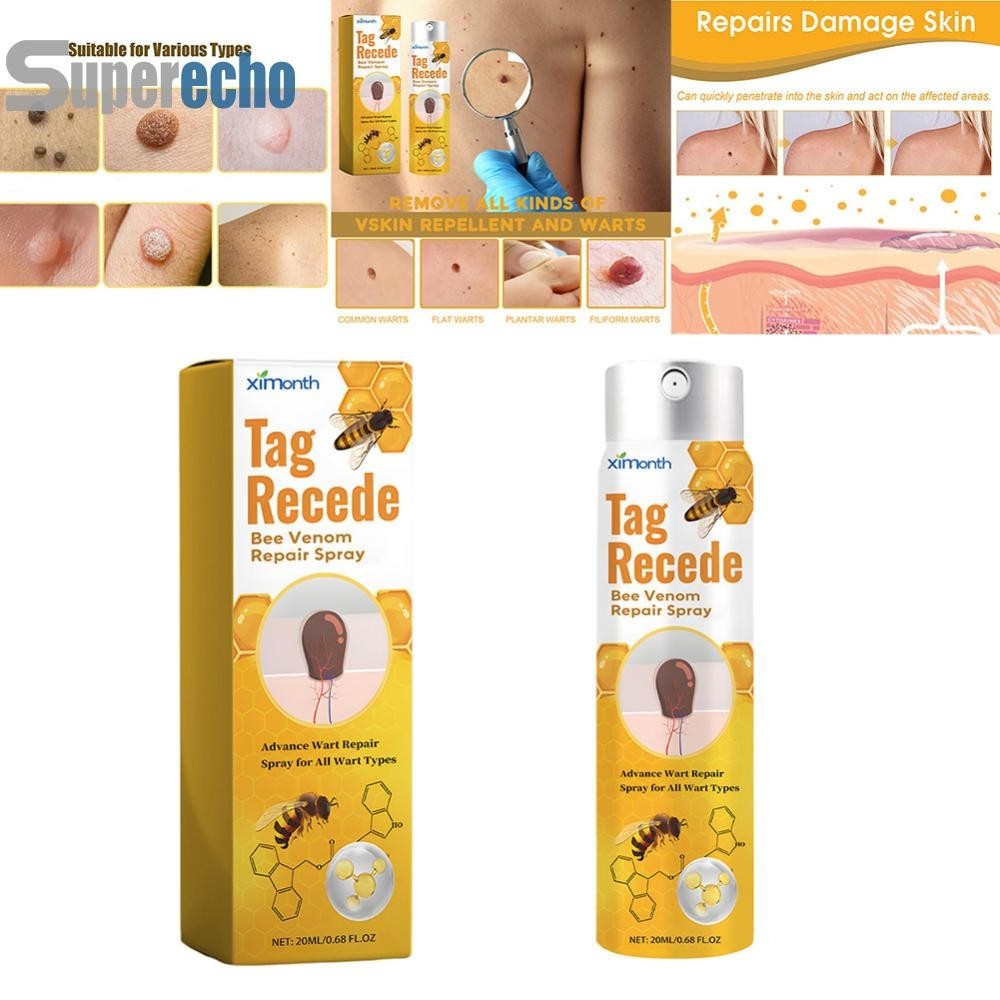 Bee Venom Treatment Spray 20ml Wart Skin Tags Removal Treatment Spray ...