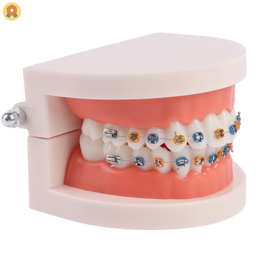 Orthodontic dental model, dentition model, illustrative model, teaching ...