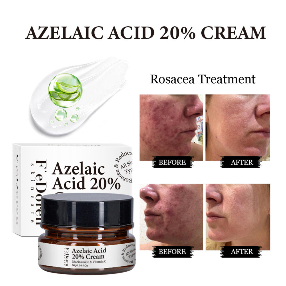 Azelaic Acid Cream, 20% Azelaic Acid Serum Cream,Face Serum Skin Care ...