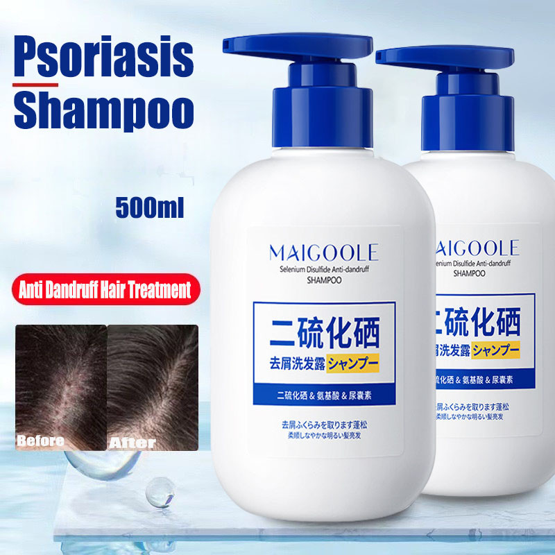 Oil Control Psoriasis Shampoo Anti Dandruff Shampoo Moisturizing Hair ...